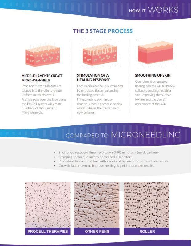 ProCell Microchanneling (Micro-needling) - CryoCareUSA