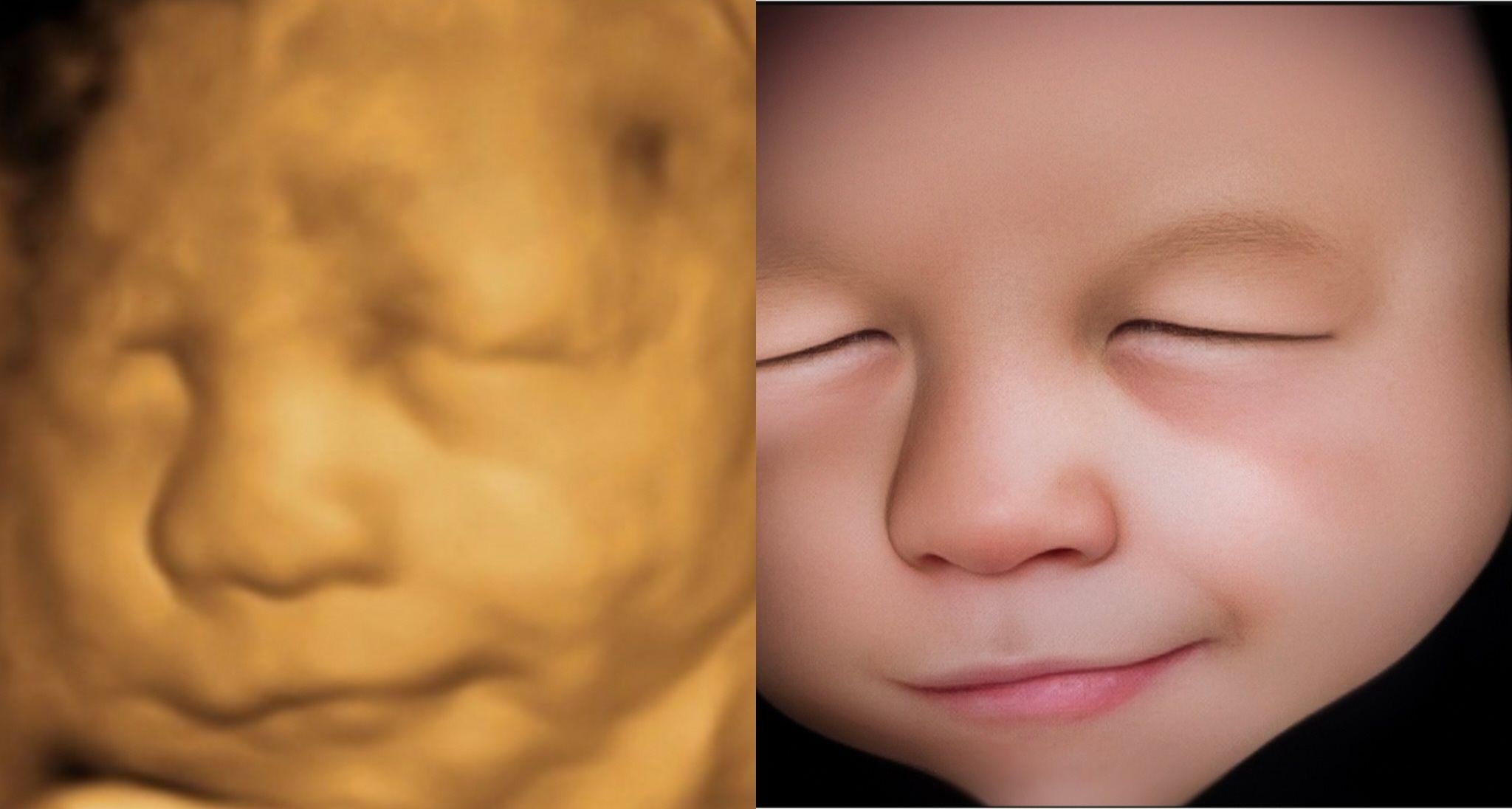 8K Image Enhancement - A Little Insight 3D/4D Ultrasound