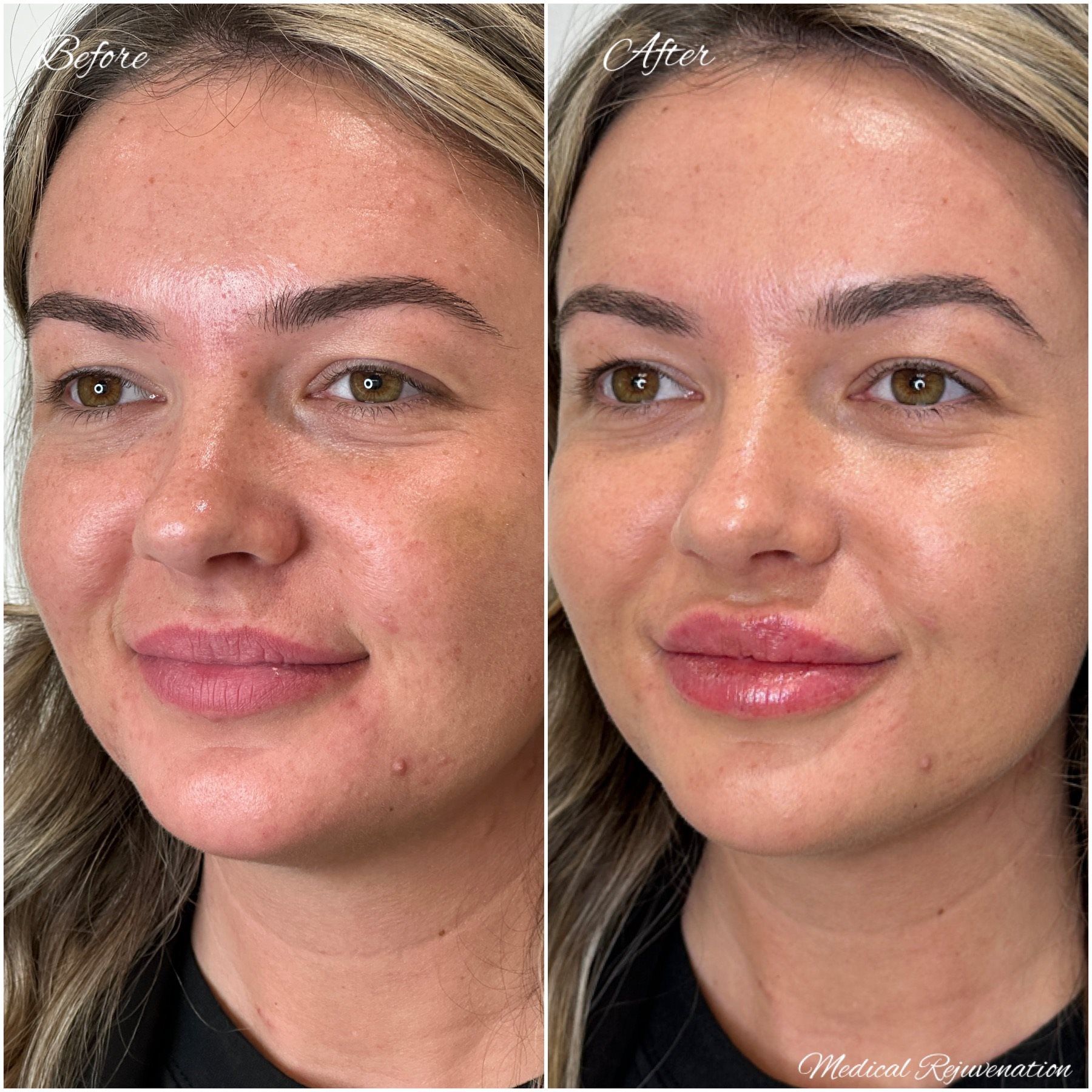 Results - Medical Rejuvenation