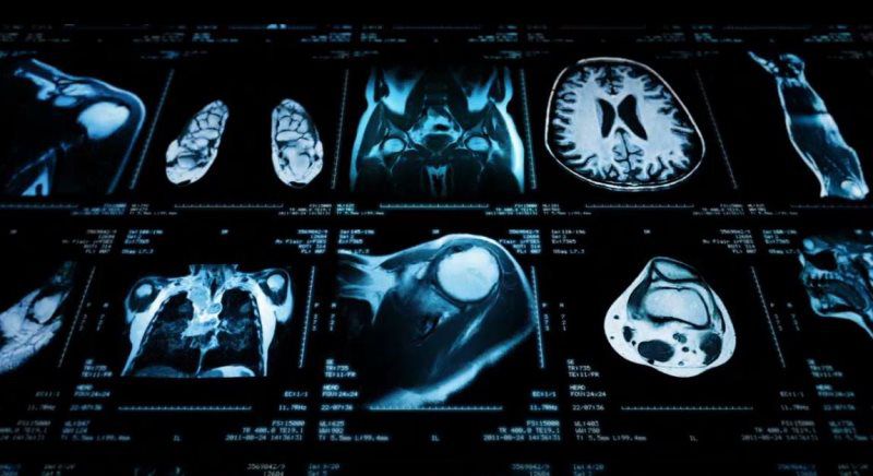 Contact Us At Any Of Our Locations Southern Radiology Specialists Forte ...