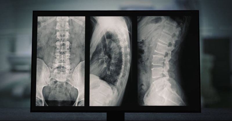 X-Ray | Southern Radiology Specialists - Southern Radiology Specialists